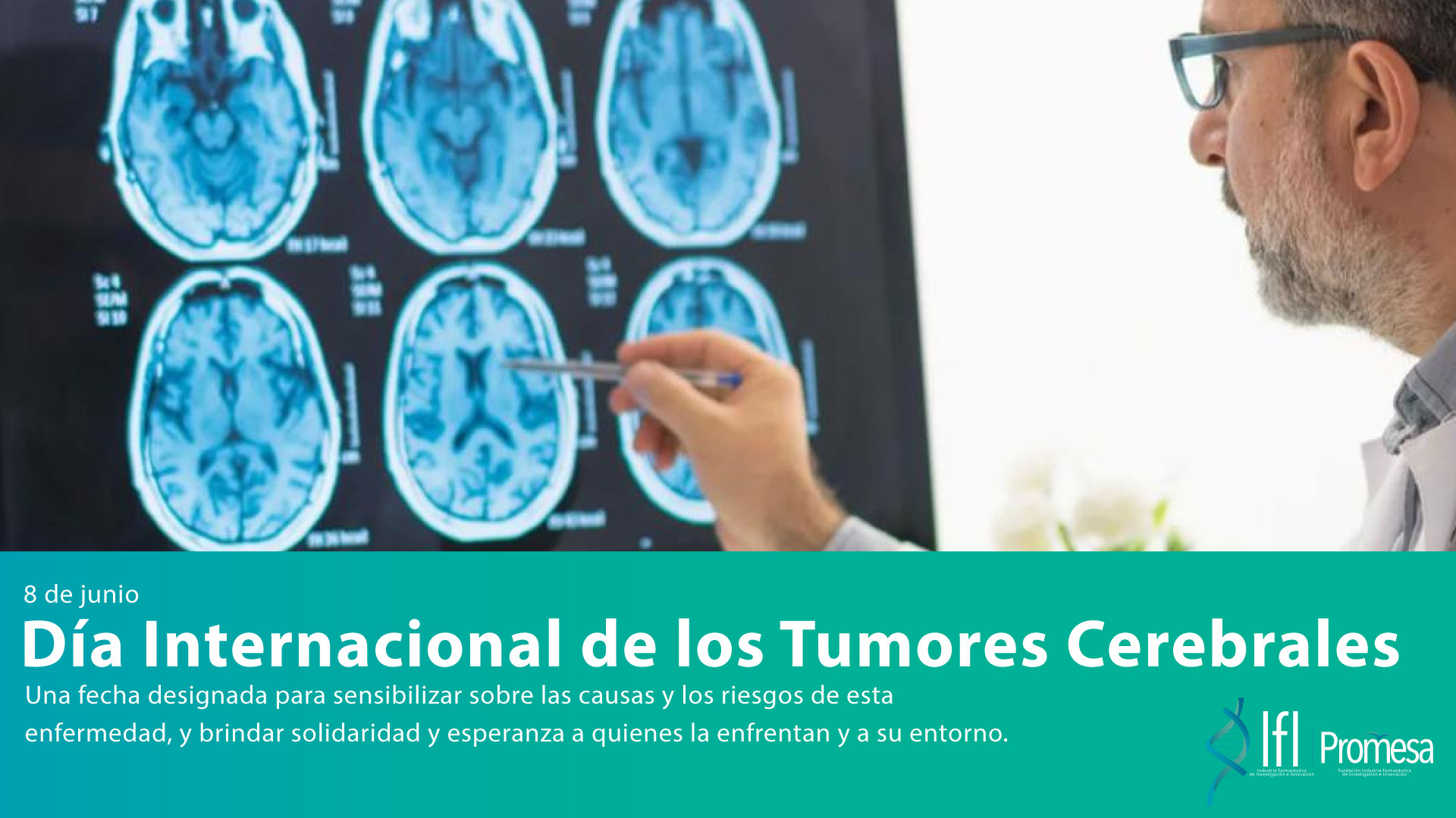 Día Internacional de los Tumores Cerebrales - IFI | Industria Farmacéutica de Investigación e ...